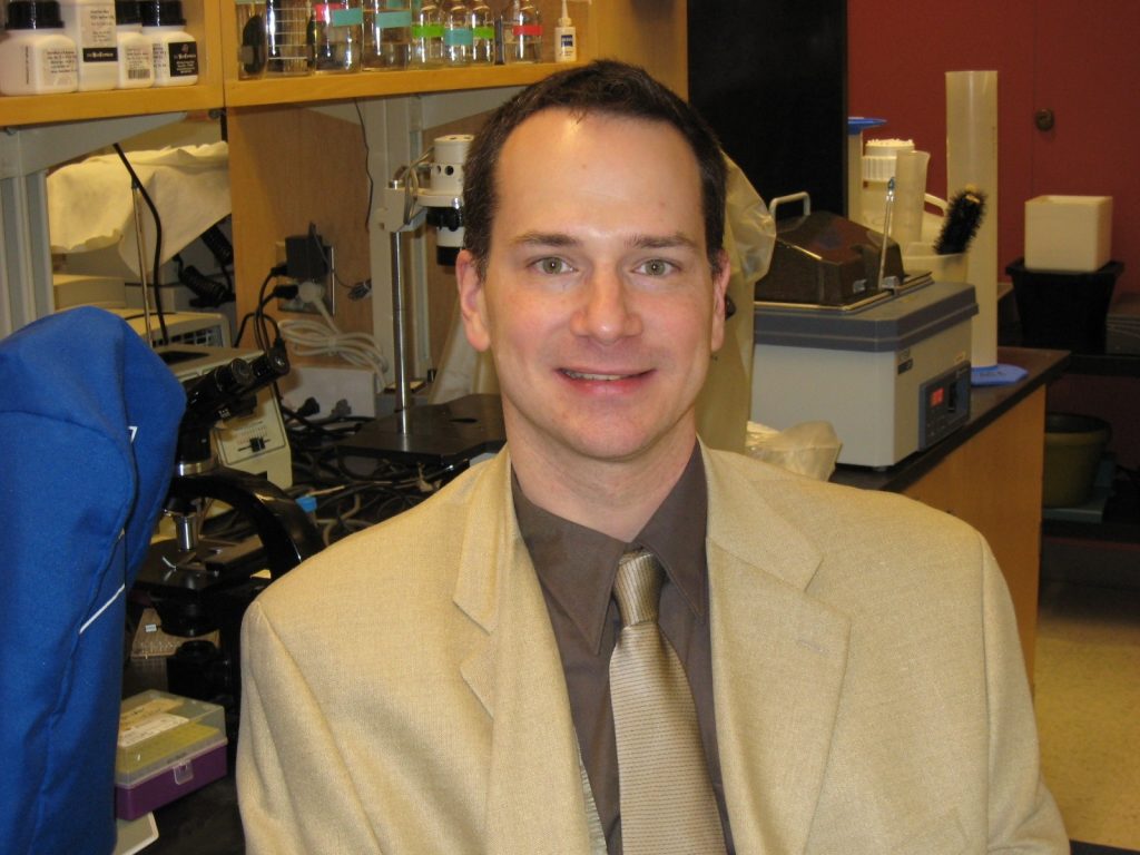 Anthony G. Brickner, PhD - Gabrielle's Angel Foundation